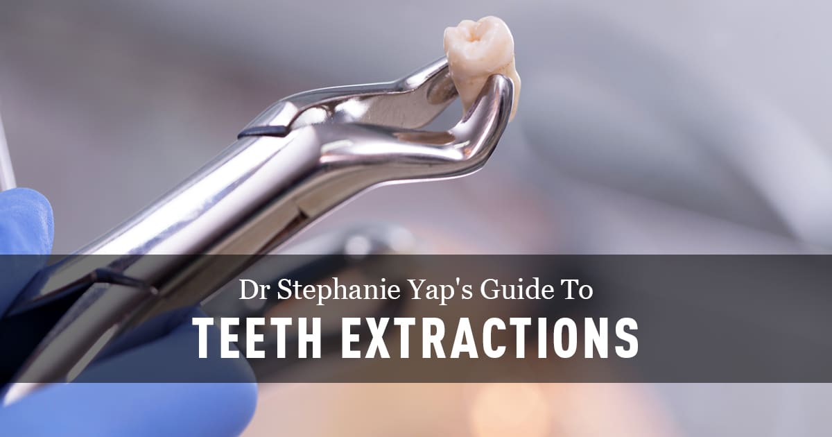 All You Need To Know About Teeth Extractions | The Dental Studio